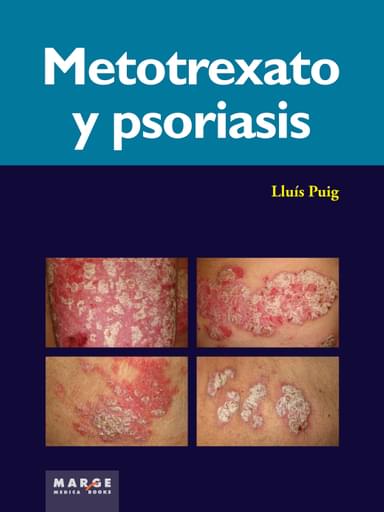 Metotrexato y psoriasis - Puig, L