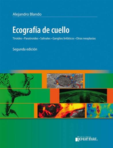 Ecografía de cuello - Blando